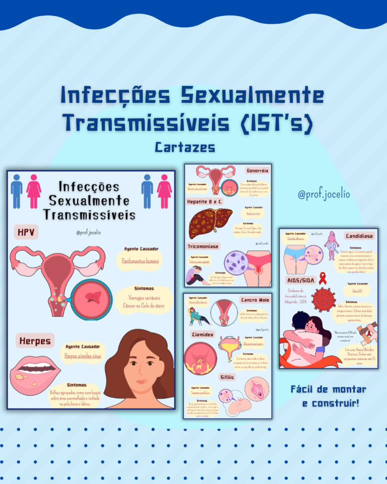 Infecções Sexualmente Transmissíveis – Cartazes – Sua Loja de ...